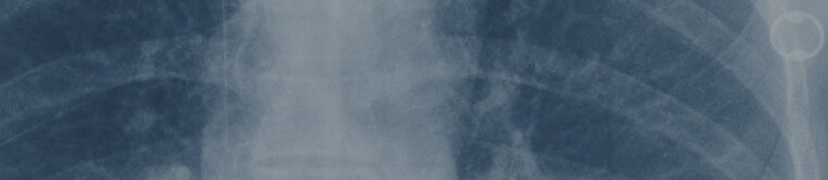 Home - AdAlta - Developing i-body drugs to treat fibrotic diseases